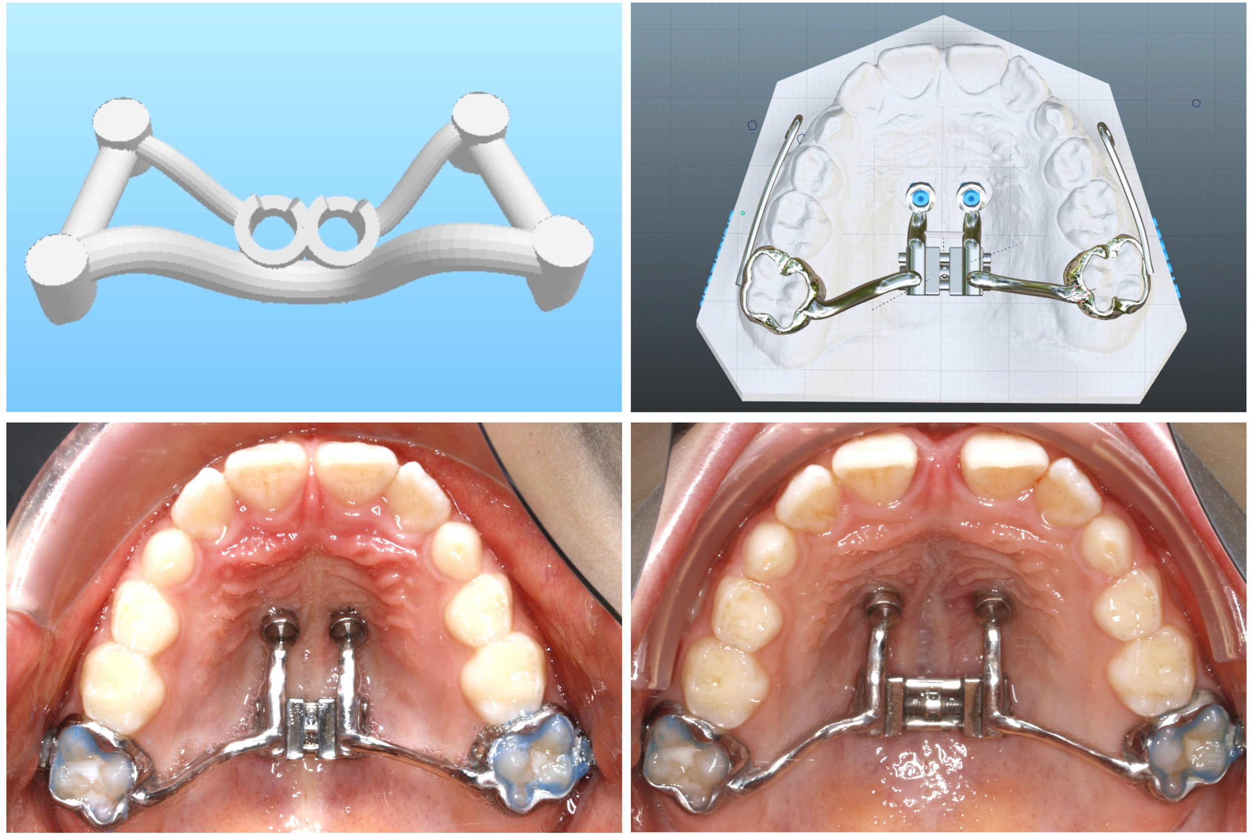 American Smiles Sterilization, Disinfection and Air Ventilation Protocols